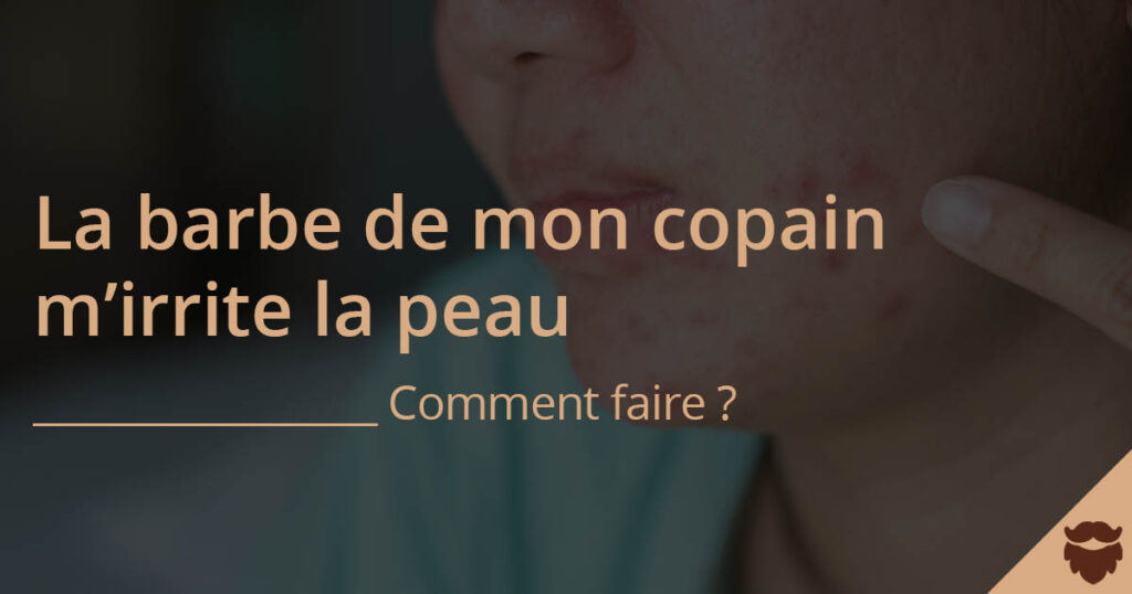 La barbe de mon copain m'irrite, pique et fait des boutons | BDW